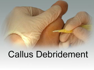 Foot Care | Diabetes Standards of Care and Resources for Clinicians and ...